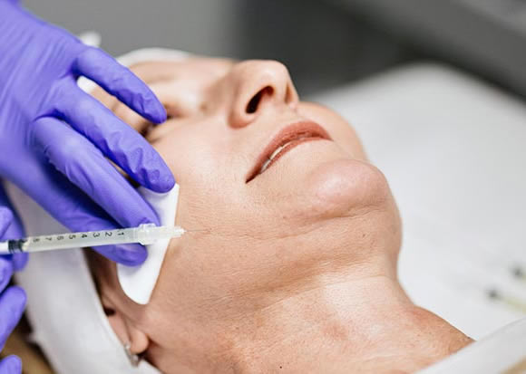 Wrinklefree Cavan - Dermal Fillers